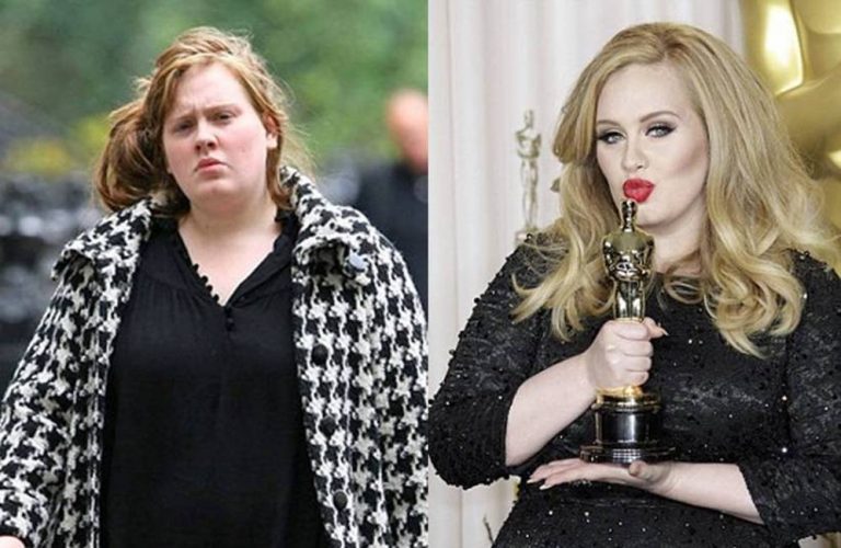 Adele’s Before and After Surgery Photos Show Proof of the Singer’s ...